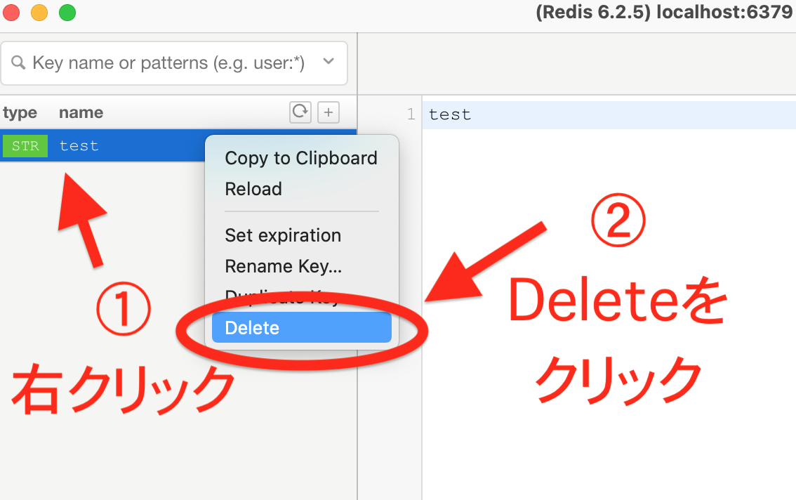 RedisのオススメGUIクライアントMedisを無料で使う方法 | 鉄駆ブログ